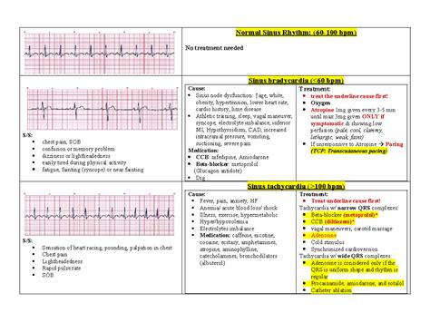 Ekg Practice Understanding Sinus Rhythm And Arrhythmias Studocu