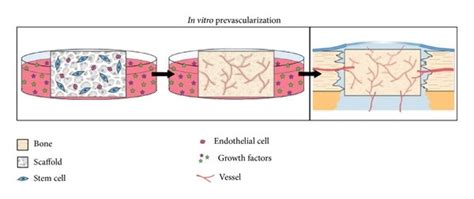 Vascularization Approaches For Bone Tissue Engineering A In Vitro