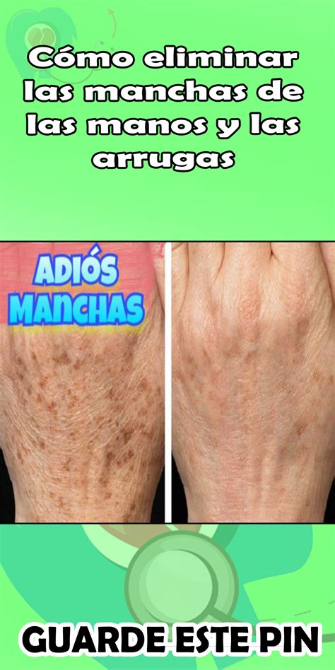 Cómo eliminar las manchas de las manos y las arrugas Natural beauty