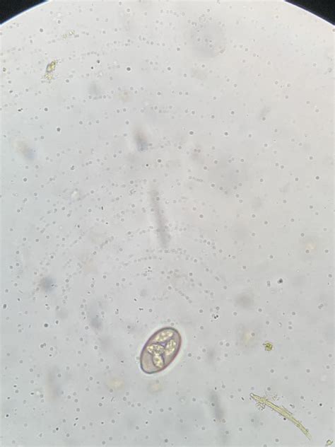 Goat Fecal Coccidia Oocyst Showing 4 Sporozoites Inside R Parasitology
