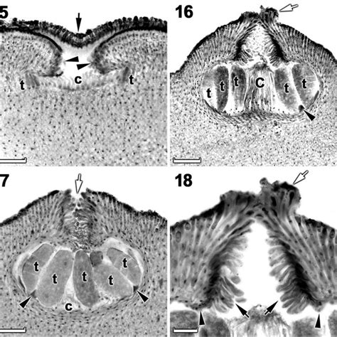 Chamberlainium Capense Spermatangial Anatomy Uwc 16 21 12 Vertical