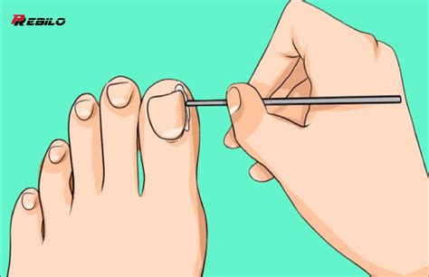 Heres Why Your Legs Cramp At Night And How To Prevent It From