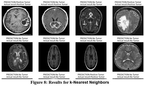 Automated Brain Tumor Detection With Advanced Machine Learning