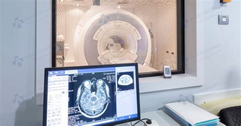 Ge Mri Scanner Models Compared