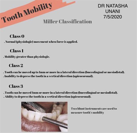 Tooth Mobility Classification Dentowesome