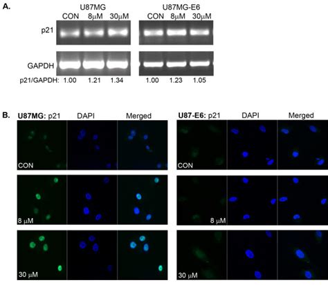 Effect Of Celecoxib On P21 Mrna Expression And Protein Localisation