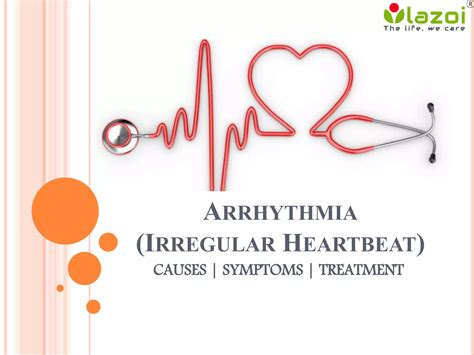 Arrhythmia Causes Symptoms And Treatment Pptx