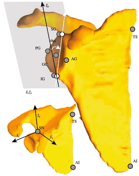 Scaling And Definition Of The Glenoid Inclination Version α Gi And α