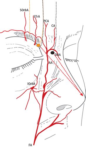 Supratrochlear Artery