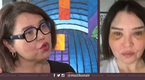 Gazeteci Esin Övet Estetik Mağduru Oldu Müzikonair