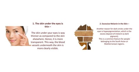 Understanding Dark Circles Under The Eyes Understanding Dark Circles Under The Eyes Page 3