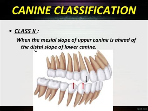 Classification Of Malocclusion