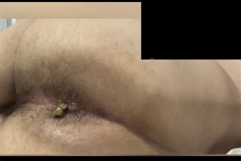 Farting And Sharting By Accident ThisVid Com