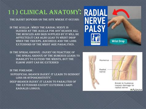 Radial Nerve Presentation Nerve Of Brachial Plexus Ppt