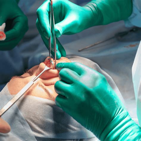 Endoscopic Turbinoplasty Surgery Nasal Congestion Treatment At Dr Ram Ent Hospital