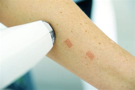 Ultrasound Testing New Jersey Vein And Vascular Institute Es