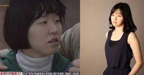 응답하라 1988 이민지 교정기 뺀 모습 보니 반전 매력 이럴수가