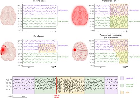 figure 1 from clinical translation of machine learning algorithms for