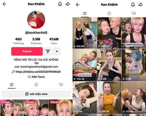 Tiktoker Triệu View Ken Khểnh Là Ai · Saostyle