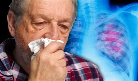 Lung Cancer Warning What Colour Is Your Phlegm Hidden Signs Revealed