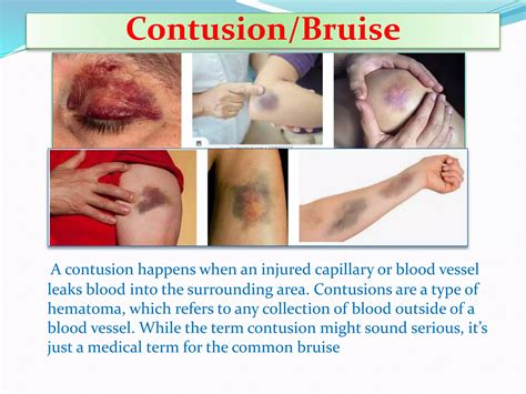 Anil Dahiya Class Xii Chapter 7 Physiology And Injuries In Sports Pptx