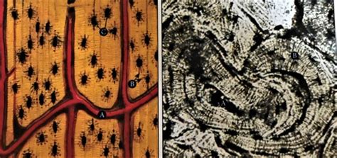 HAP Lab Chapter 6 Introduction To Skeletal Systems Photos Flashcards Quizlet