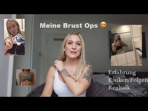 Alles Ber Meine Brustvergr Erung Erfahrung Vorher Nachher Fotos