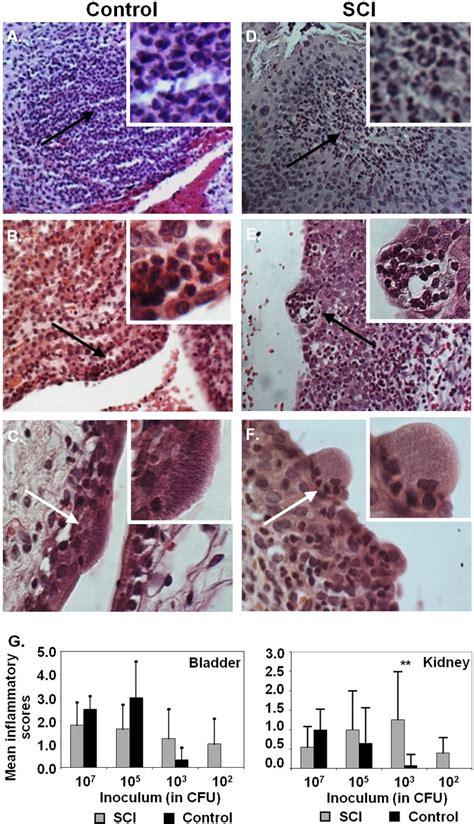 Both Sci And Control Rats Develop Cystitis And Pyelitis During Acute Download Scientific