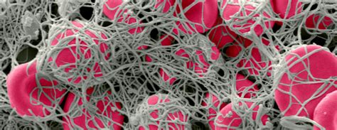 Antithrombin Iii Blood Test