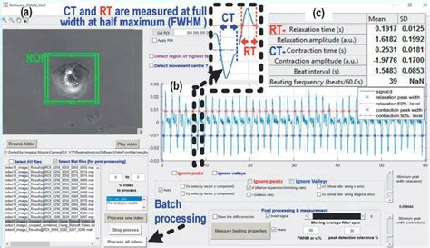 An Advanced Cardiomyocyte Movement Analysis Software Cman A Software