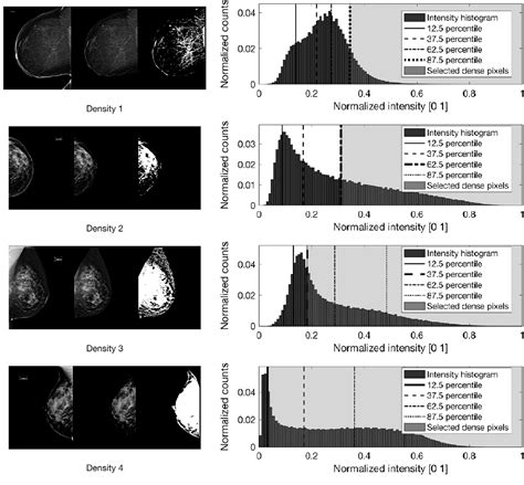 Figure 1 From Automated Mammographic Breast Density Estimation Using A Fully Convolutional