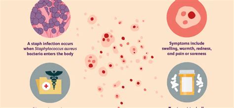 Staphylococcus Aureus Signs Of Infection What Is The Treatment Like