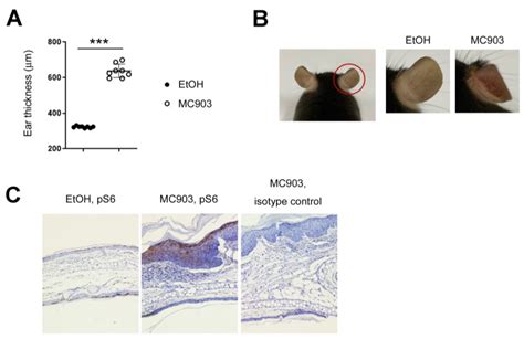 Mtorc1 Deficiency Prevents The Development Of Mc903 Induced Atopic Dermatitis Through The