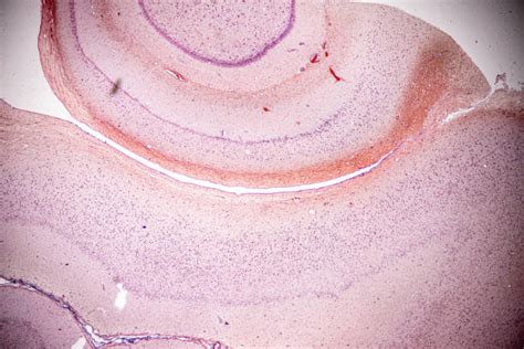 960 Hematoxylin And Eosin Staining Foto Stok Potret And Gambar Bebas Royalti Istock