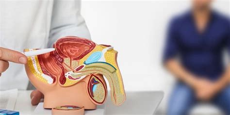 Reabilitação Peniana Pós Cirurgia Radical Da Próstata Conheça As