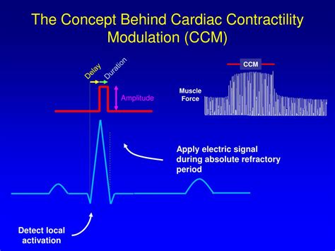 Ppt Multicenter Randomized Controlled Trial Of Cardiac Contractility Modulation In Patients