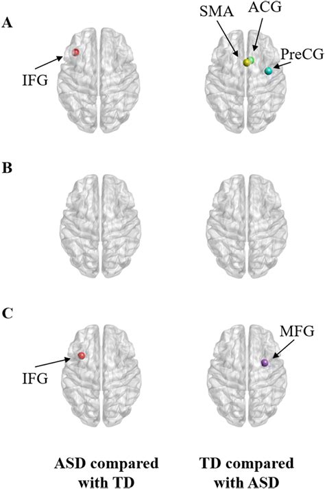 Brain Patterns Showing Differences In Convergence For Inhibition By