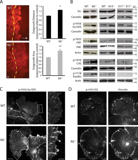 Loss Of K6 Leads To Sfk Activation In Wound Induced Keratinocytes A