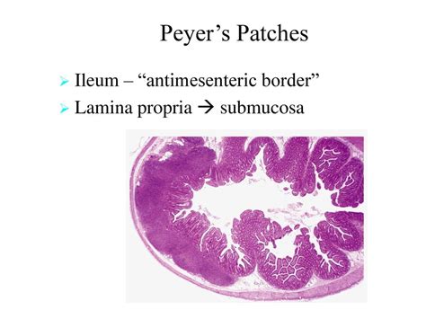 Immune Lymphatic System 1 Introduction And Organisation Ppt Download