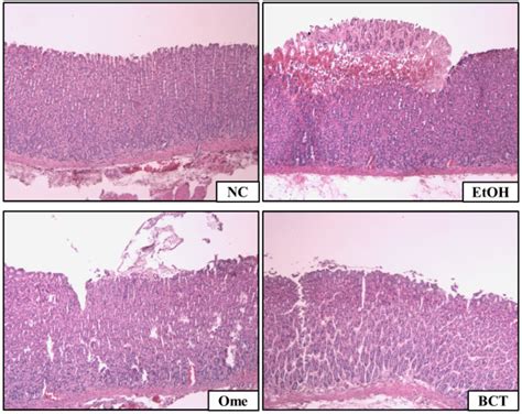Histopathology Of The Gastric Mucosa Absolute Ethanol Induced