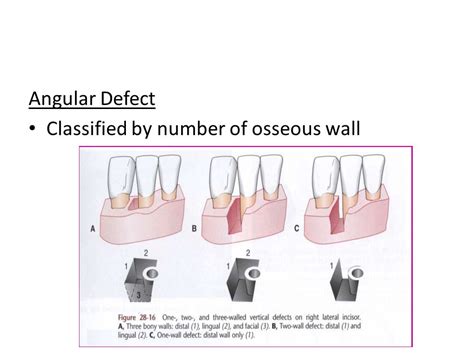 Pbl Smoking Cessation Group Ppt Video Online Download