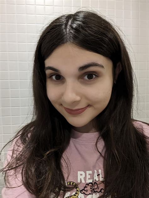 1 5y Mtf Hrt Might Get My Forehead Done Is There Anything Else Clockable R Transpassing