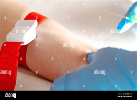 Womans Vein Ready For Intravenous Injection During Pandemic Stock