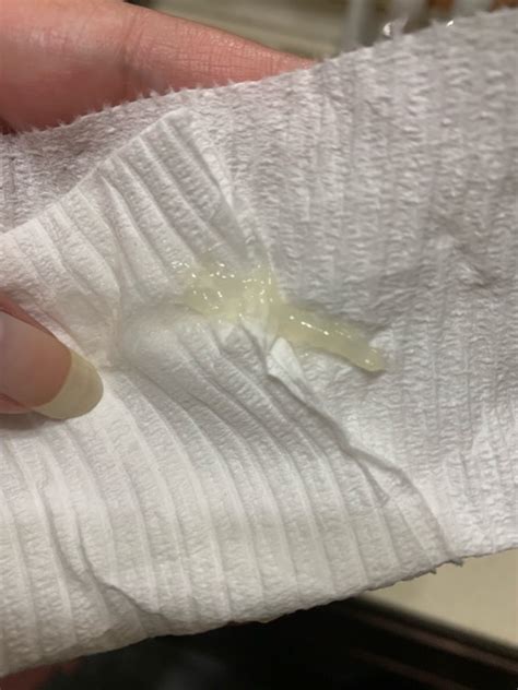 Part Of Mucus Plug Or Discharge Glow Community