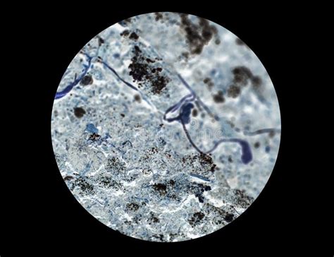 Bacteria Or Cells Under A Microscope Multiplication Of Bacteria Or Infection Scientific