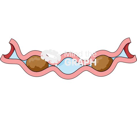 Intestine Segmentation 1