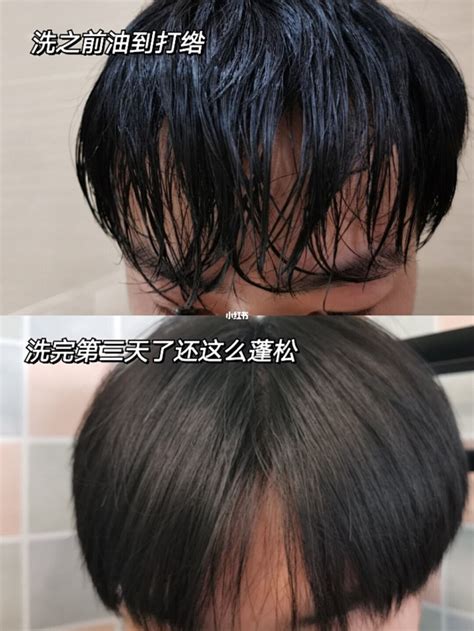 解救大油头～男生头发油腻就得用它 解救大油头～男生头发油腻就得用它 不知道你们有没有过头发油腻得天天洗头的经历 反正我是饱受其害 不仅头发