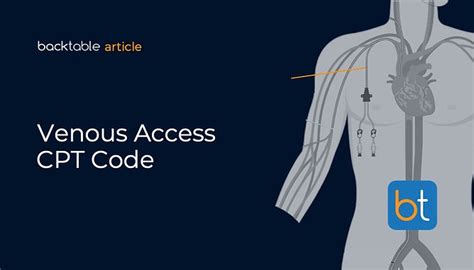2025 Venous Access Cpt Code Backtable