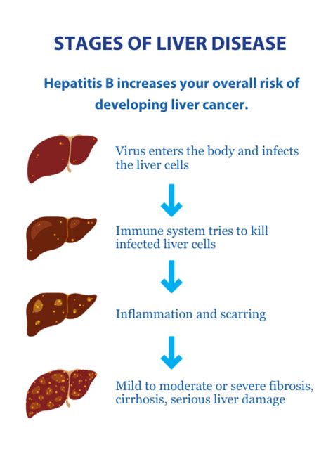 Your Liver The Hepatitis Foundation Of New Zealand