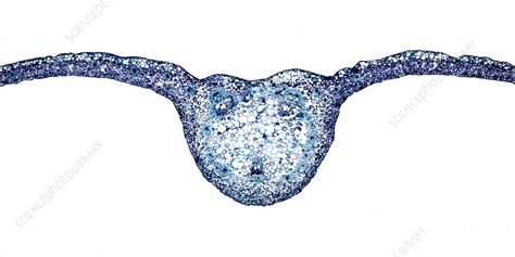 Venus Flytrap Leaf Cross Section Light Micrograph Stock Image C0494155 Science Photo Library